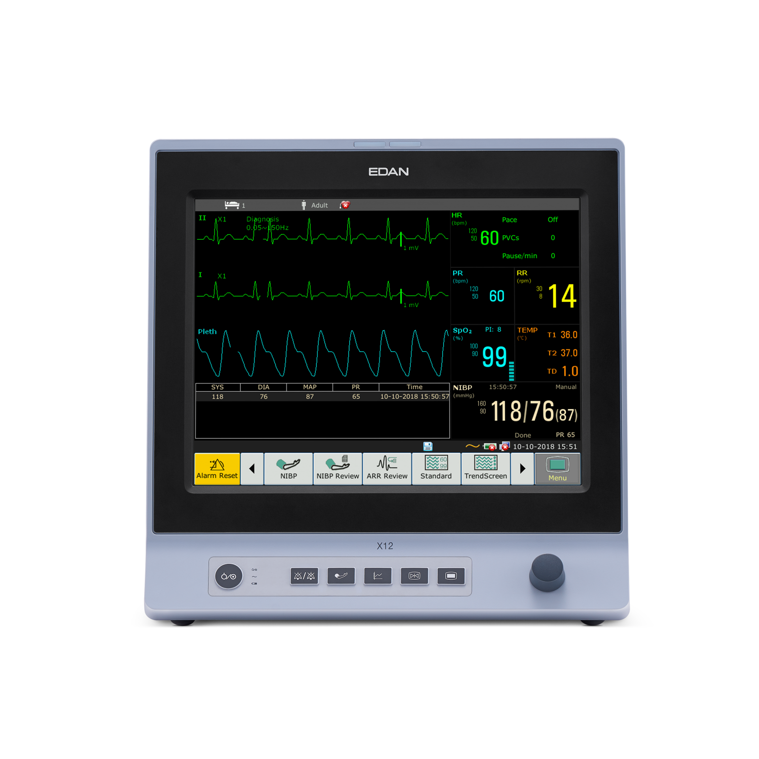 Masimo Root Platform with Radical-7 Pulse CO-Oximeter - MDPRO USA