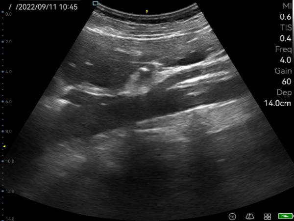 What are the Soloscan P50 Advantages? - MDPRO USA